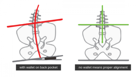 That terrible habit of sitting on wallets - Norwest Chiro Blog